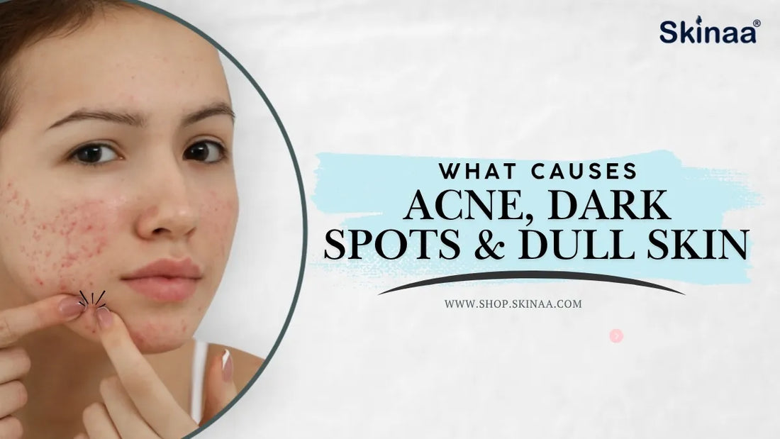 What Causes Acne, Dark Spots & Dull Skin? – Skinaa