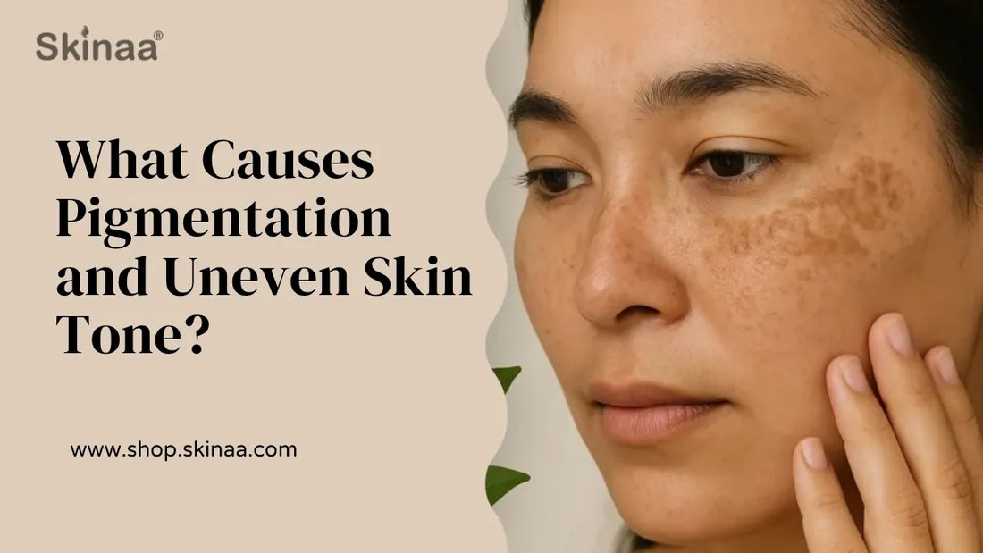 What Causes Pigmentation and Uneven Skin Tone? – Skinaa